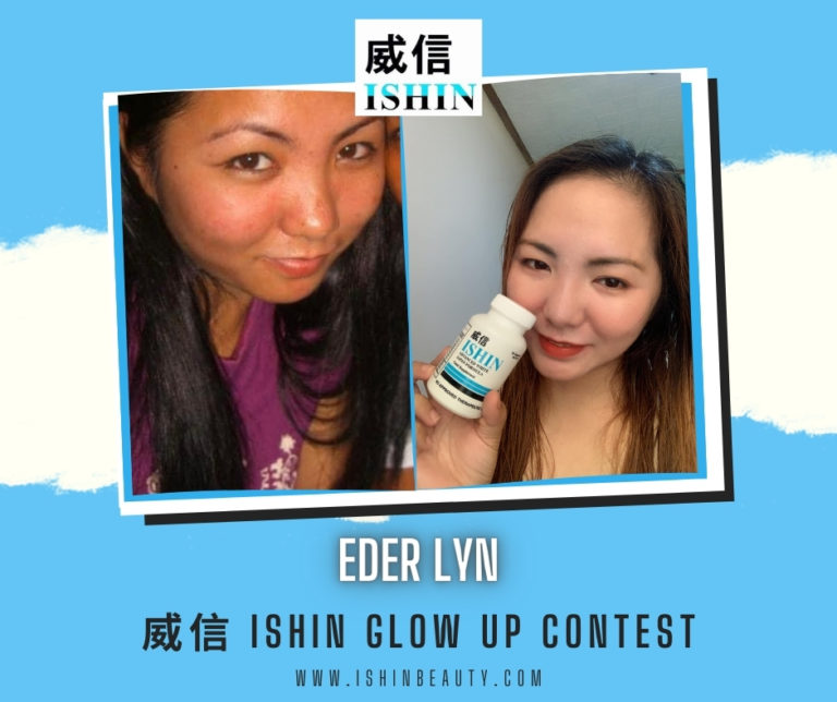 Eder Lyn Ishin Glow Up Story