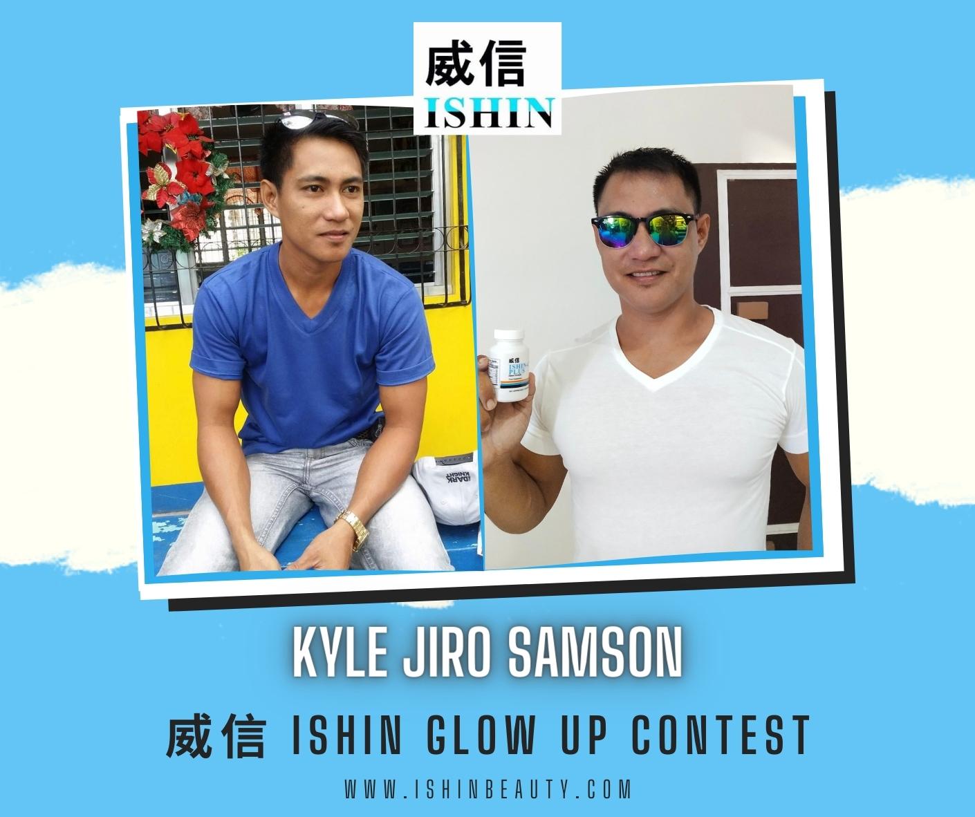 Kyle Jiro Samson Glow Up Story - Ishin